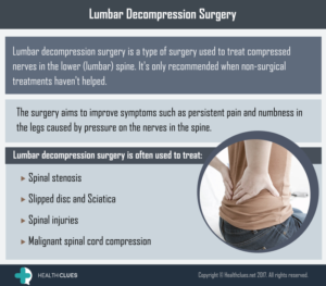 Lumbar decompression surgery